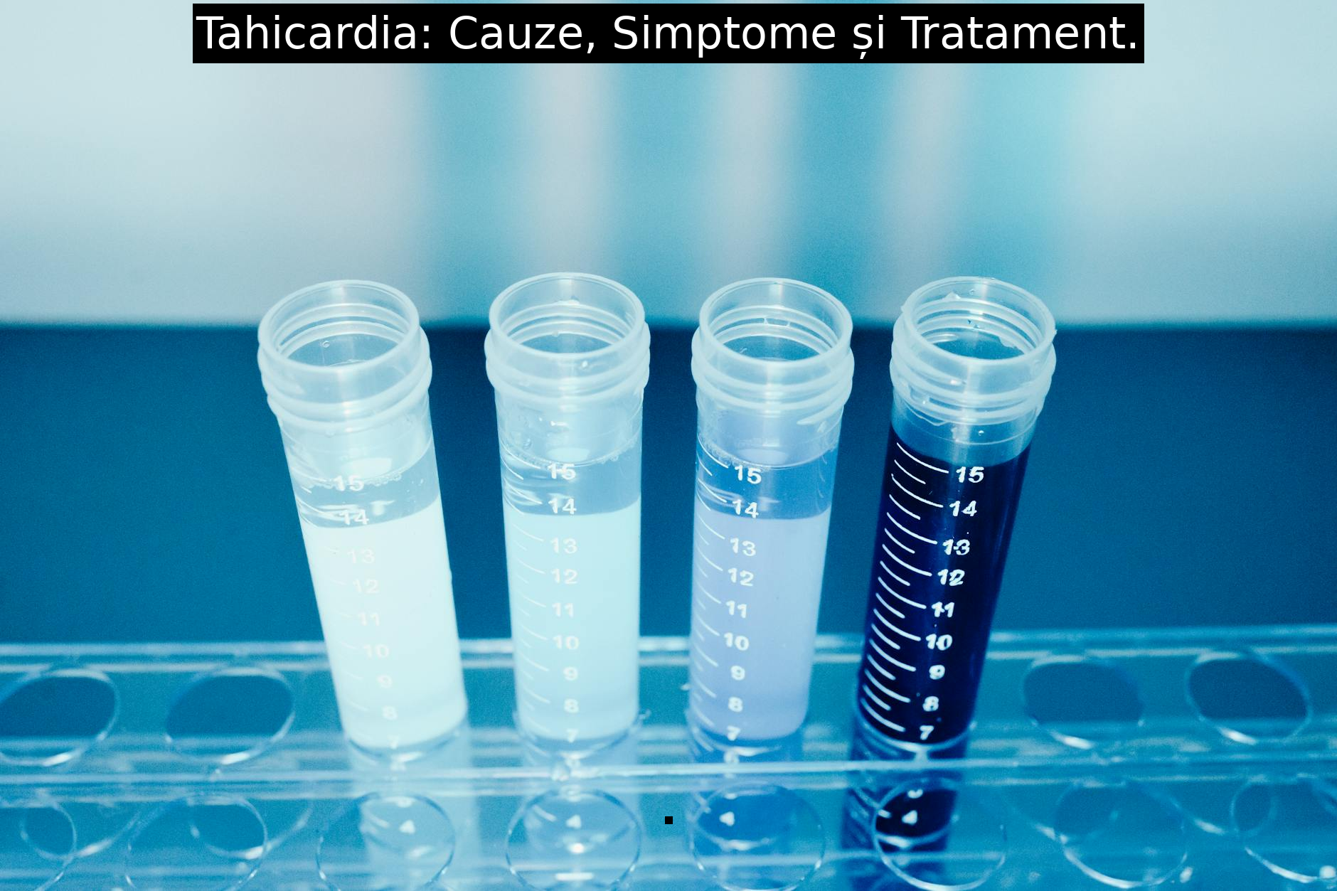 Tahicardia: Cauze, Simptome și Tratament. - Doctorite