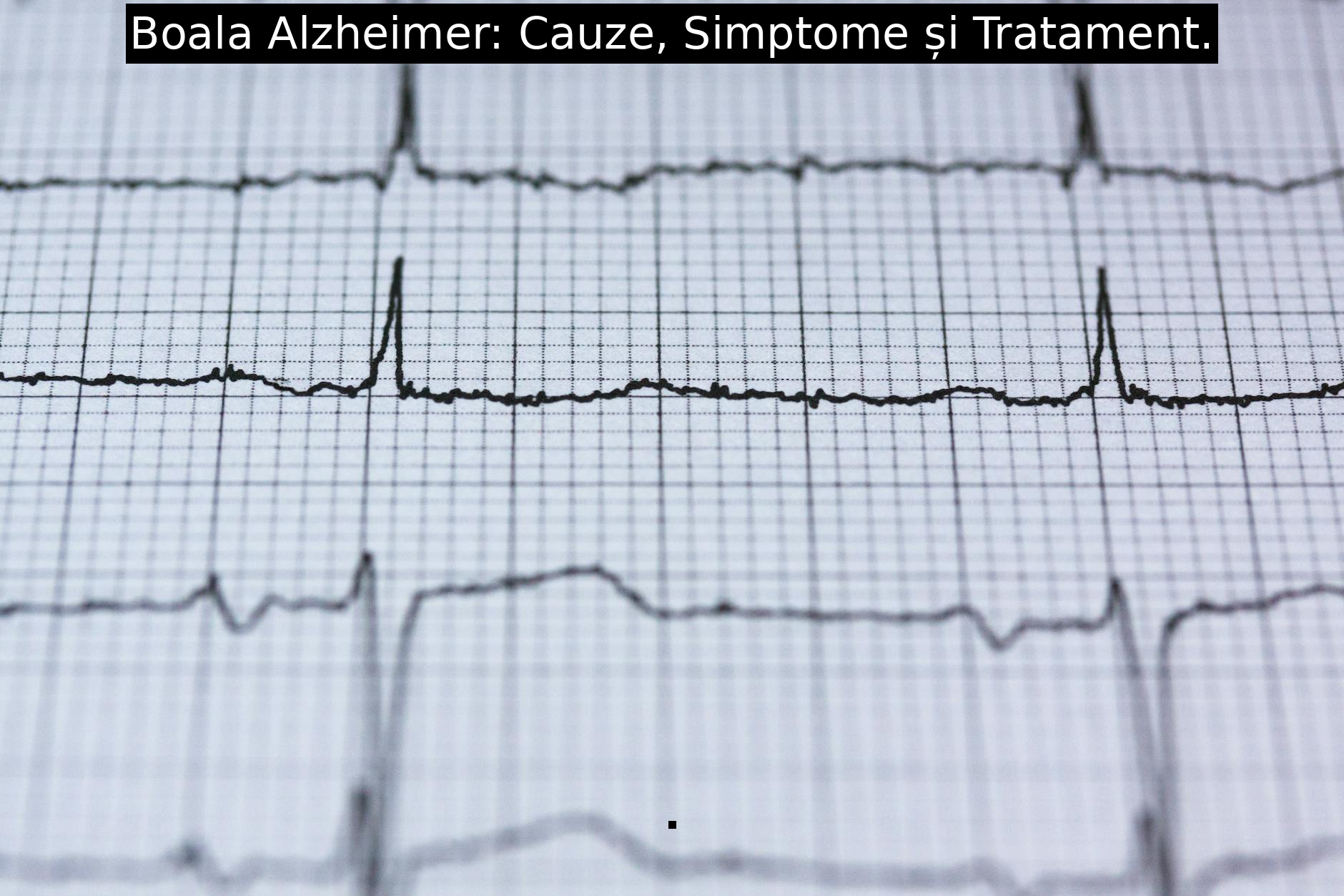 Boala Alzheimer: Cauze, Simptome și Tratament. - Doctorite Boala Alzheimer: Cauze, Simptome și Tratament. - Doctorite