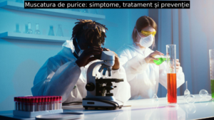Muscatura de purice: simptome, tratament și prevenție - Doctorite