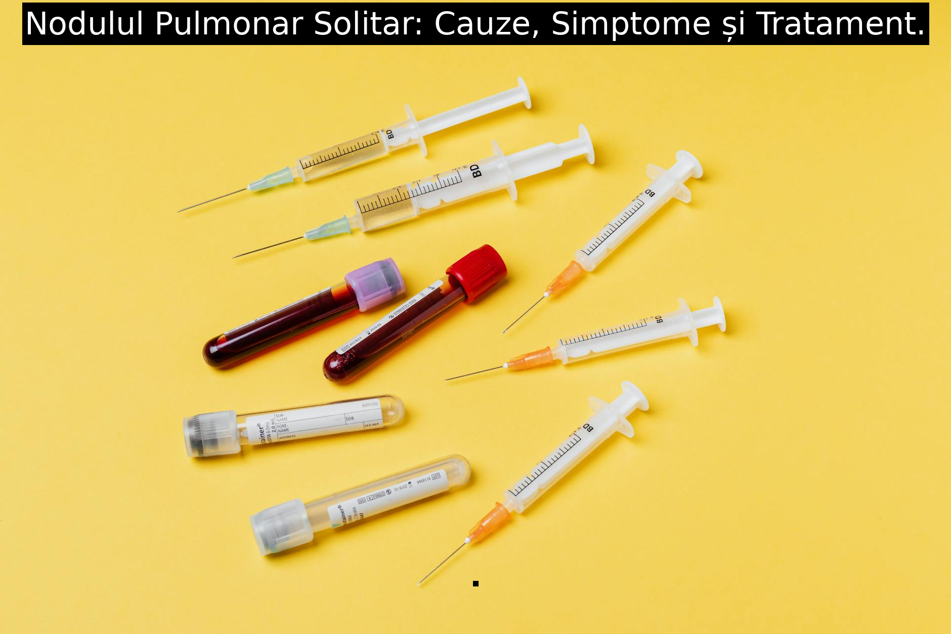 Nodulul Pulmonar Solitar: Cauze, Simptome și Tratament. - Doctorite